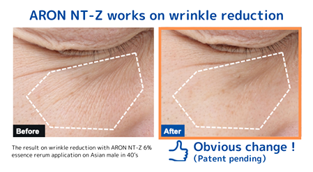 ARON NT-Z | Ingredients Spotlight | Cosmetic Ingredients | Chemical ...